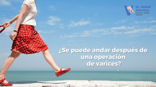 Andar después de una operación de varices, ¿sí o no? | Dr Sánchez Varices